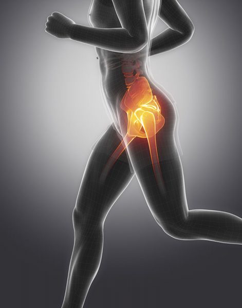 Hip Osteoarthritis: Hip joint osteoarthritis pain form the hip experts ...