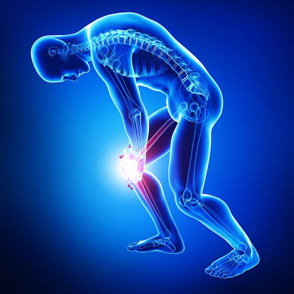 Quadriceps Tendinitis: Quadriceps tendon pain in the thigh