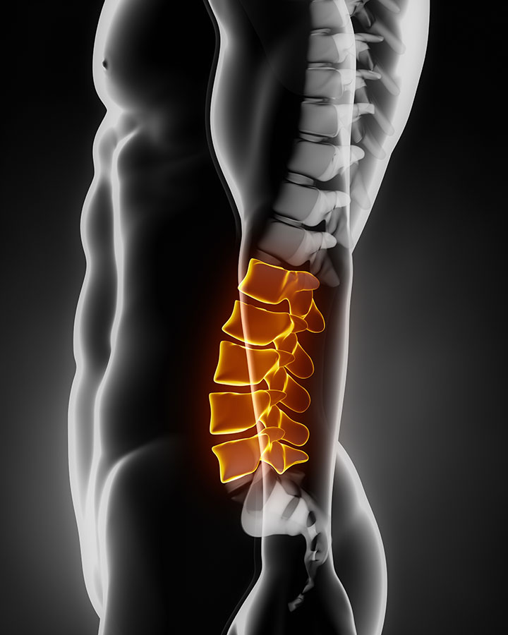 Lower Back Pain Treatment, Causes, Symptoms Relief, Self tests