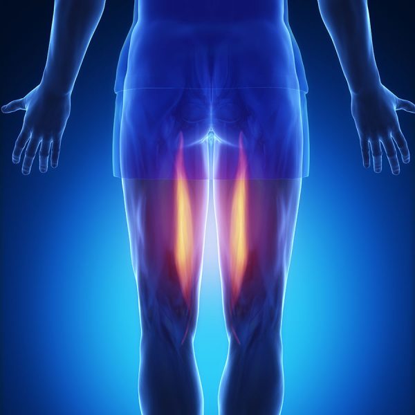 Hamstring tear, Hamstring strain: Torn Hamstring Muscle Treatment