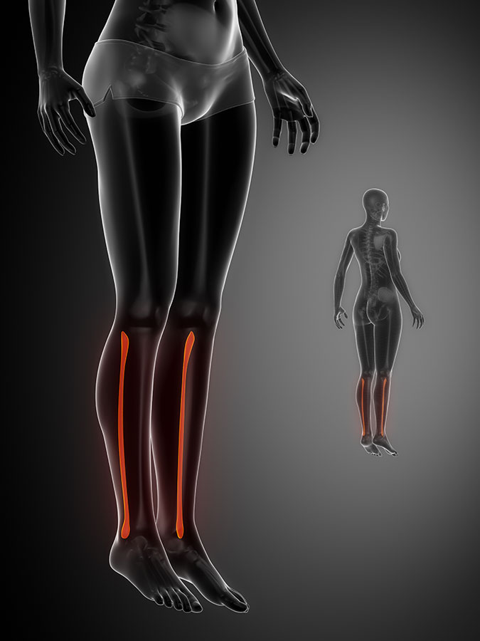 Torn Ligament: Types, Tests & Treatment - Ligament injury @WHP