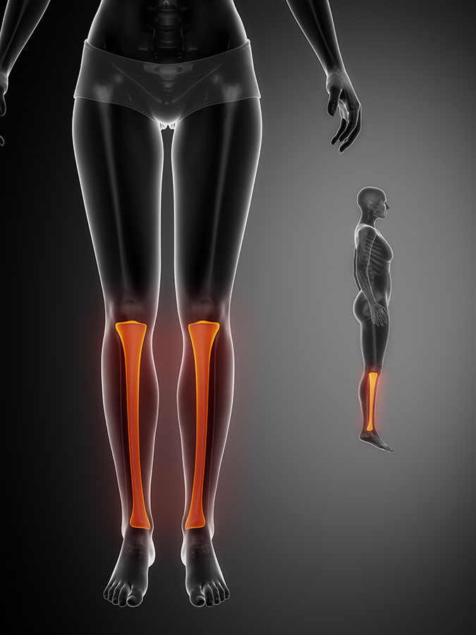 Shin Pain, Shin Injuries: Shin splints treatment - Physiotherapist Pretoria