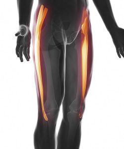 ITB syndrome, Iliotibial band syndrome Treatment, Pain, Cause, Exercises