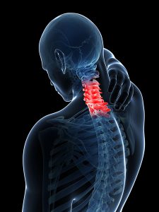 Neck Disc injury - Slipped Neck Disc: Slipped the disc in your neck