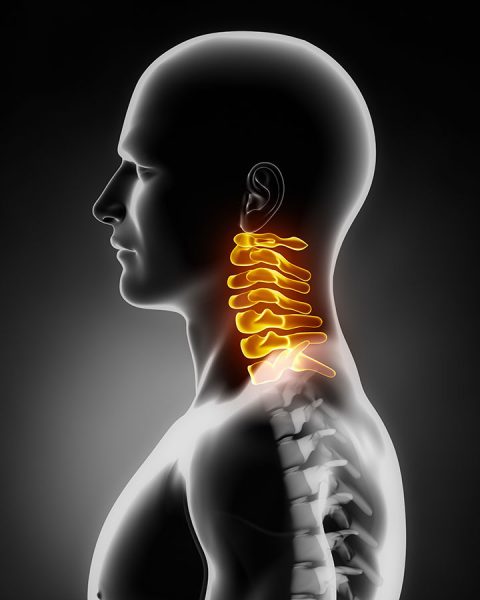 Cervical spondylosis means Neck Joint Degeneration: Stiff neck joints
