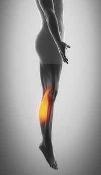 Calf Muscle Tear or Calf Strain: Calf muscle treatment