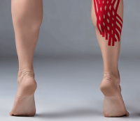 Calf Muscle Tear or Calf Strain: Calf muscle treatment