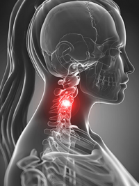 Neck Muscle Spasm? Stiff neck muscles - Get rid of neck muscle pain
