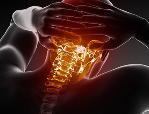 Neck Muscle Spasm: Why neck muscles spasm? - Physio Pretoria