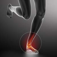 Foot pain, Foot injuries: Foot muscle pain: Physiotherapist Pretoria